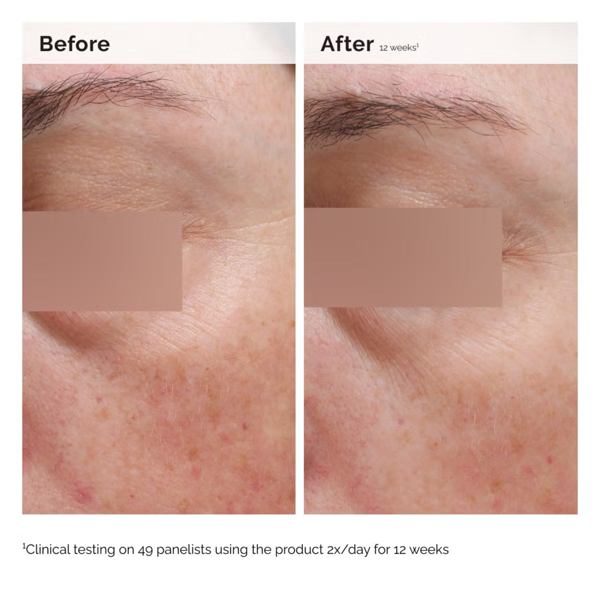 The Ordinary Niacinamide 5% Face And Body Emulsion 100ml – HWS Beauty